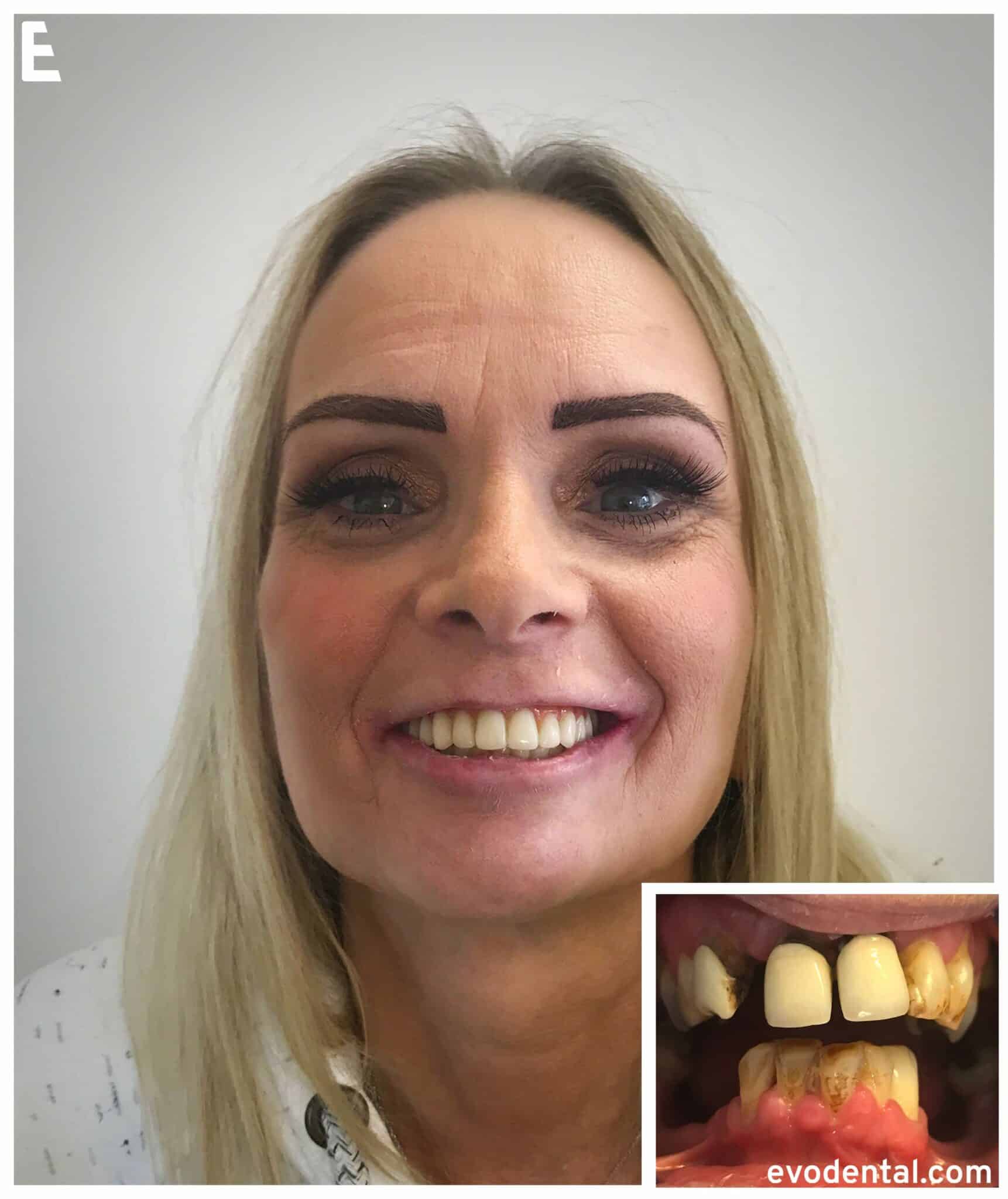 EvoDental – The Dental Implant Experts – Multiple UK 5* Rated Clinics