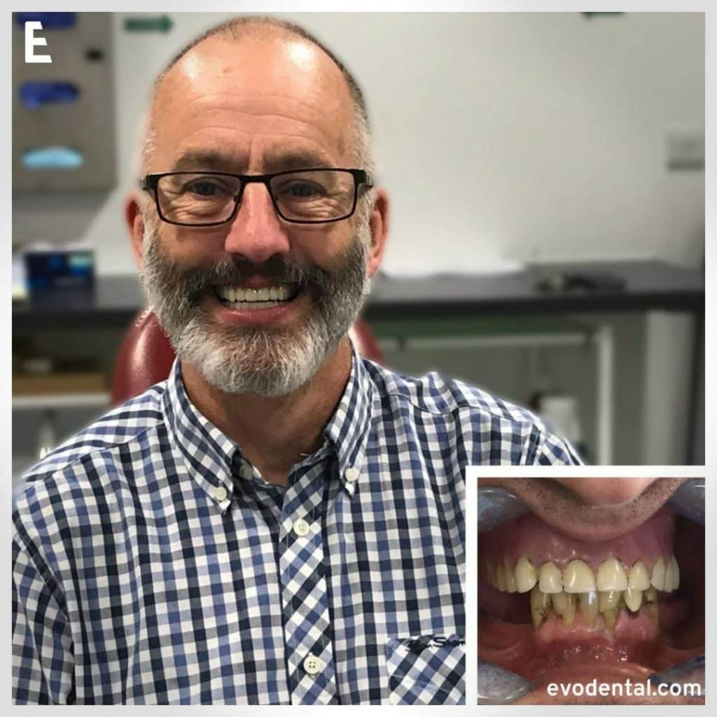 EvoDental – The Dental Implant Experts – Multiple UK 5* Rated Clinics