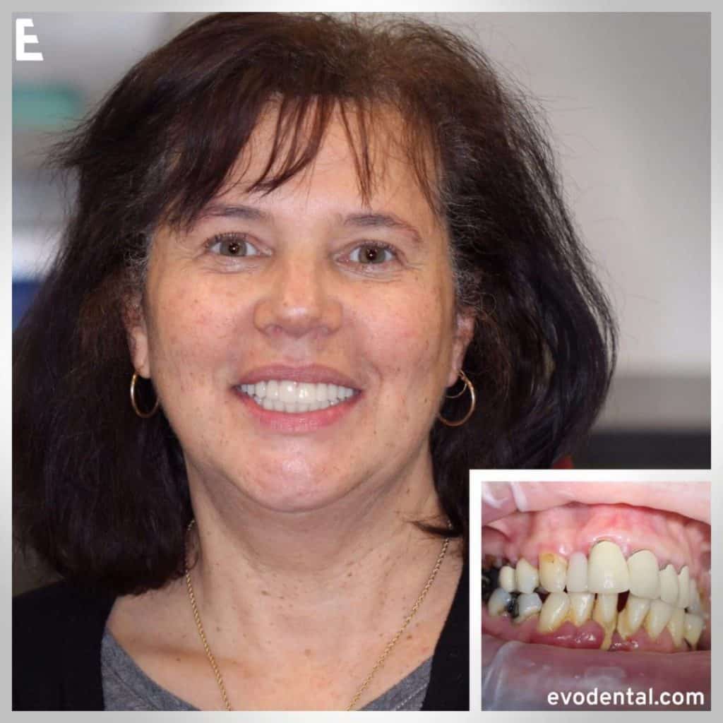 EvoDental – The Dental Implant Experts – Multiple UK 5* Rated Clinics