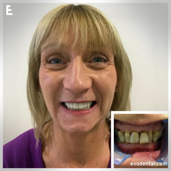 EvoDental – The Dental Implant Experts – Multiple UK 5* Rated Clinics