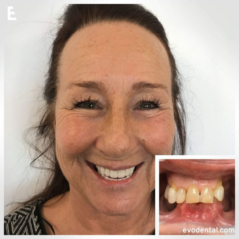 EvoDental – The Dental Implant Experts – Multiple UK 5* Rated Clinics