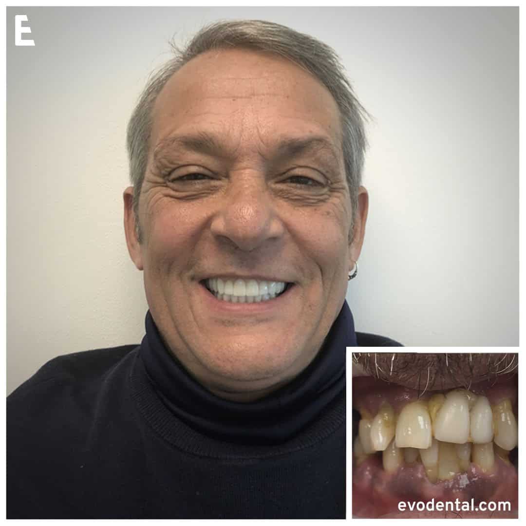 EvoDental – The Dental Implant Experts – Multiple UK 5* Rated Clinics